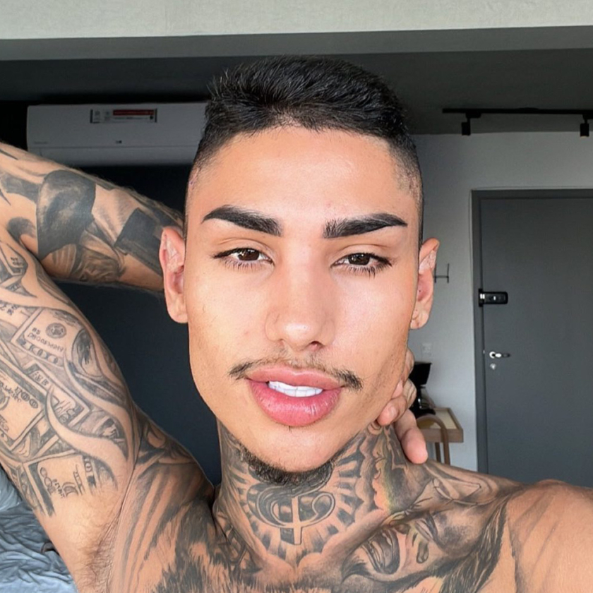 Fox Eye Surgery (Full Guide) - Op. Dr. Mustafa Yazır