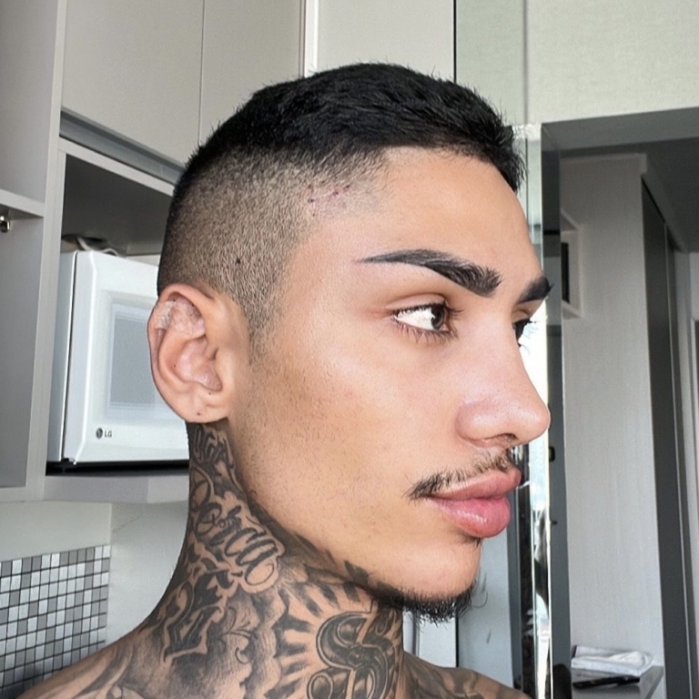 Fox Eye Surgery - Op. Dr. Mustafa Yazır